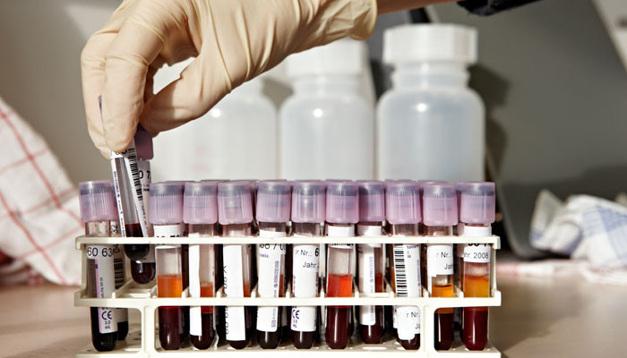 Gendoping im Sport - Deutsche Sporthochschule Köln