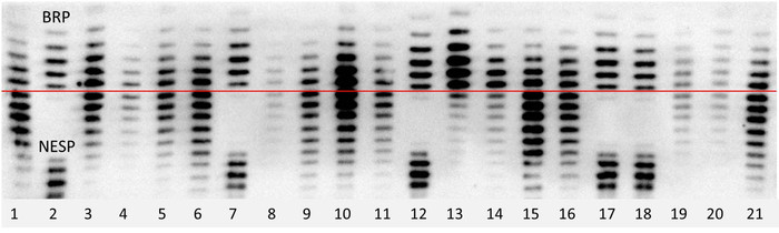 Erythropoietin (EPO) - Nachweis - Institut für Biochemie, Deutsche ...